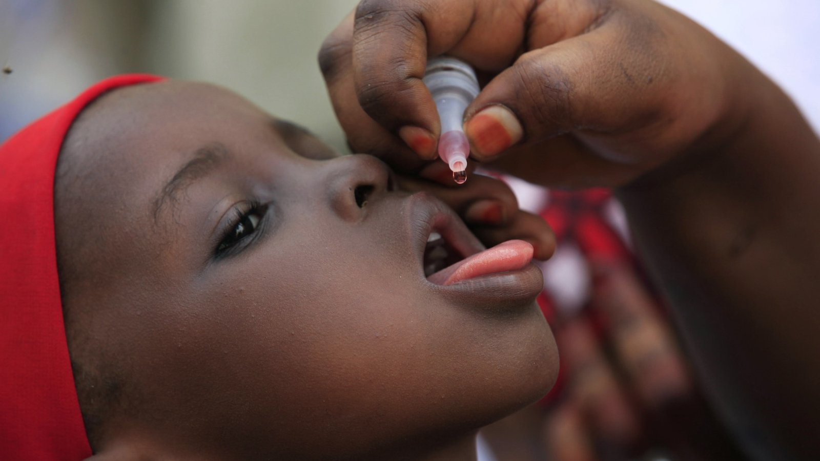 17 Important Facts You Might Not Know About Polio