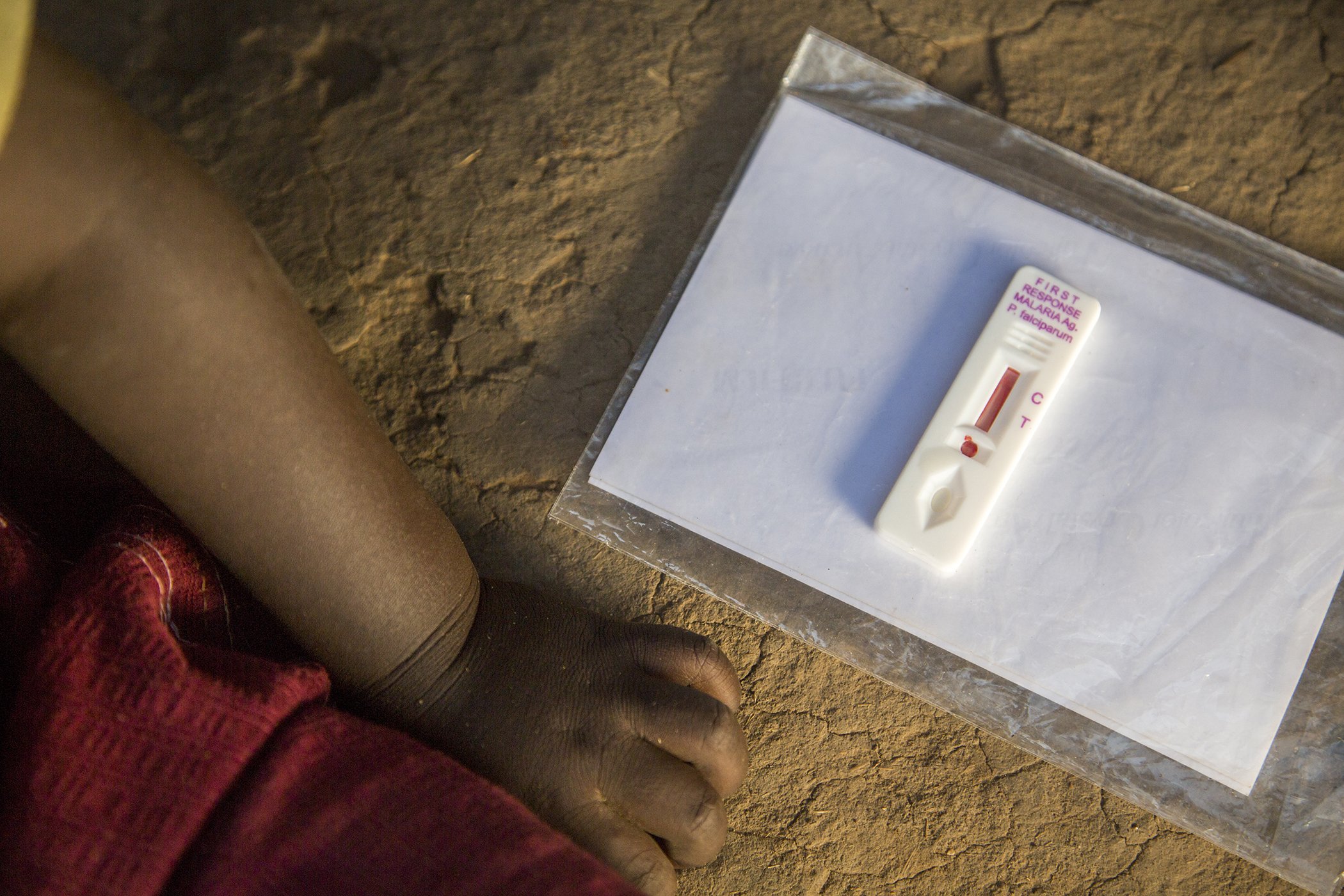 As a Malian, the Slogan 'Zero Malaria Starts With Me' Has Special Meaning
